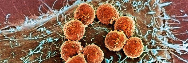 Immunotherapy at MSK | Memorial Sloan Kettering Cancer Center